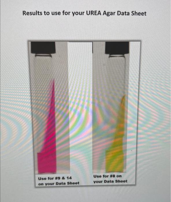 Solved Nane - _- ins Eection Urea Hydrolysis (Urease Test) | Chegg.com