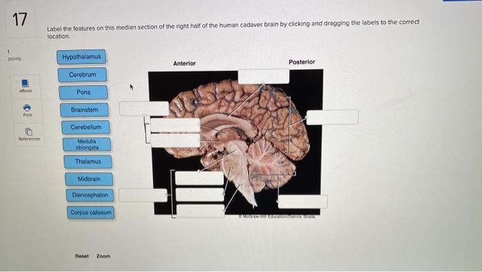 Solved 17 Label the features on this median section of the | Chegg.com