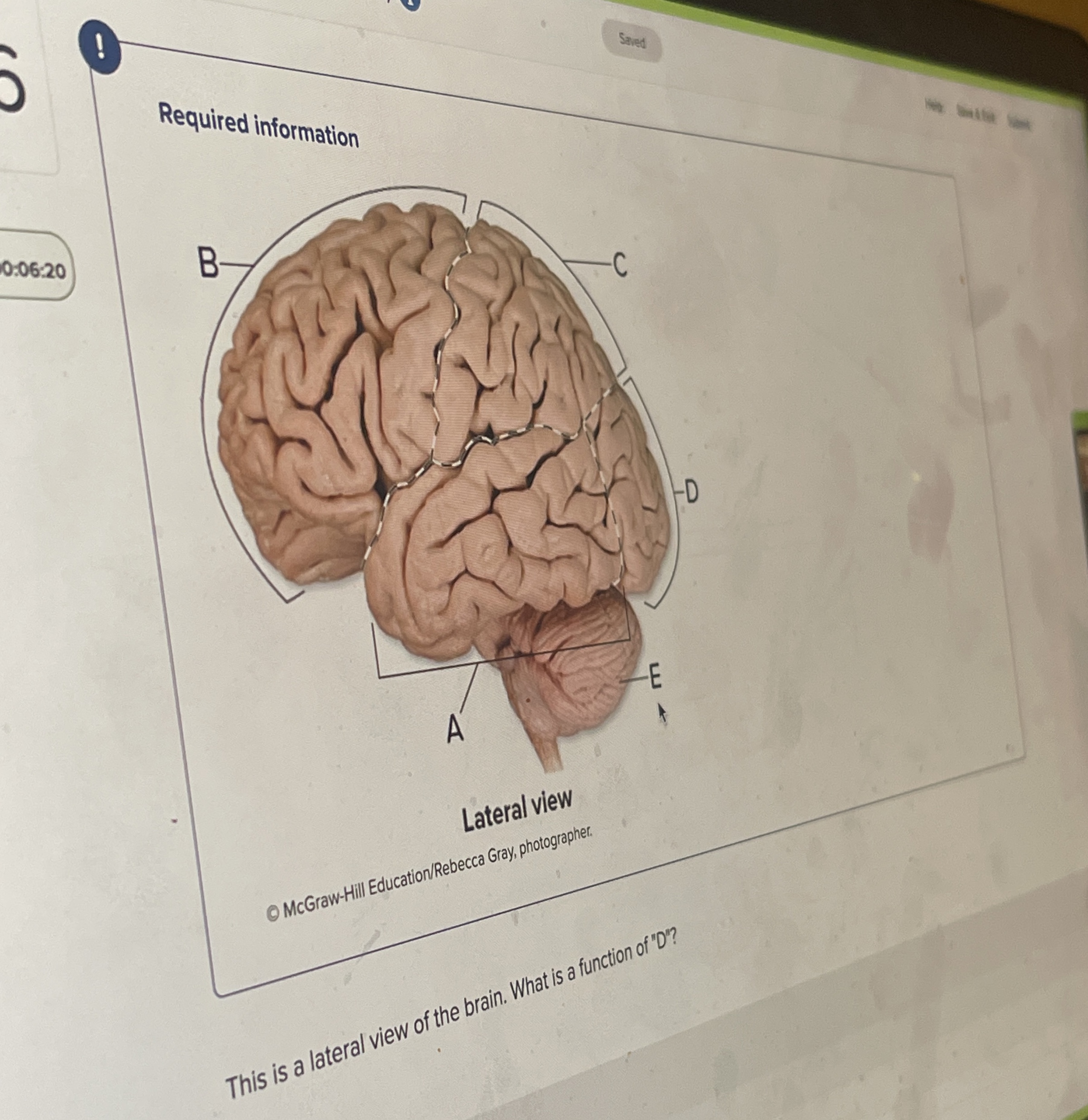 Solved SavedRequired informationLateral view of the brain. | Chegg.com