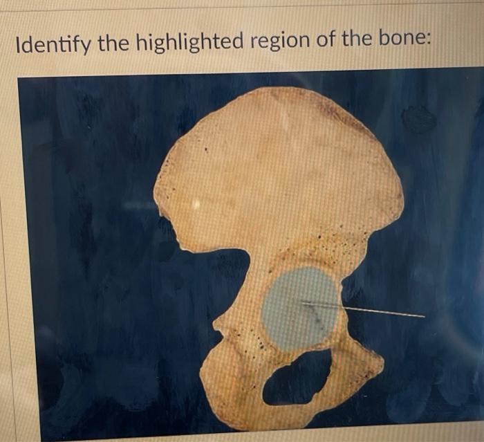 Solved Identify the highlighted bone: Identify the | Chegg.com