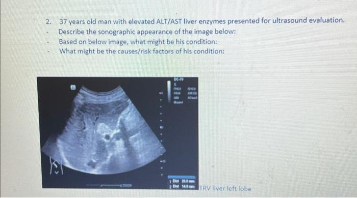 Solved 2. 37 years old man with elevated ALT/AST liver | Chegg.com