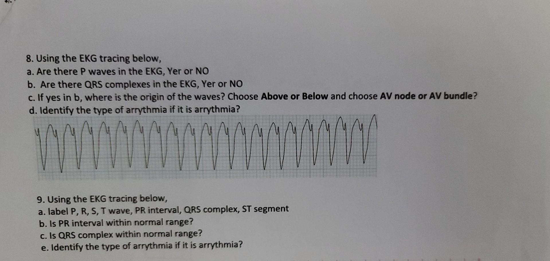 8. Using the EKG tracing below, a. Are there P waves | Chegg.com