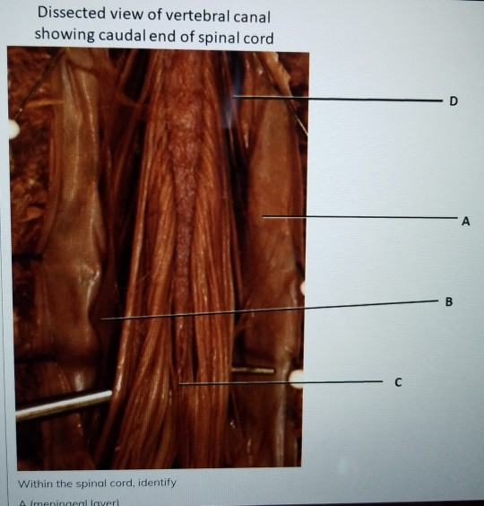 Solved Dissected view of vertebral canal showing caudal end | Chegg.com