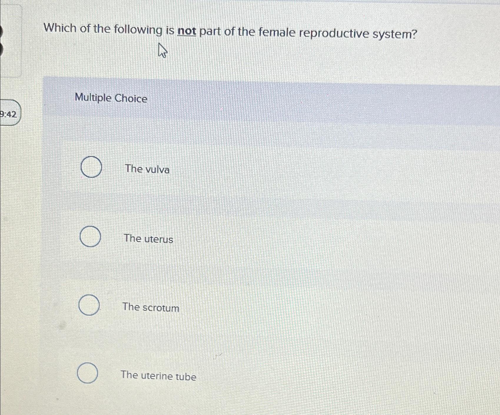 Which of the following is not part of the female | Chegg.com