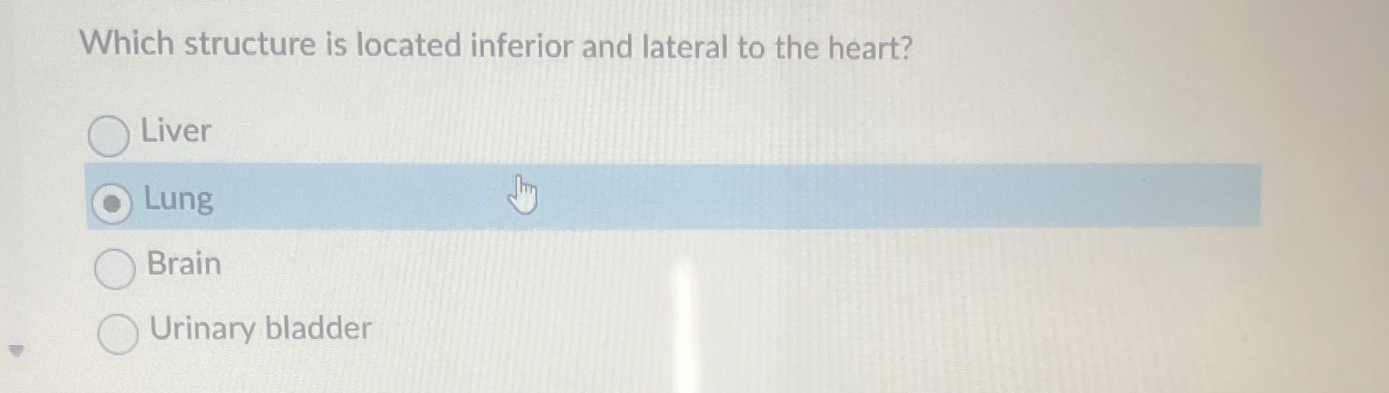 Solved Which structure is located inferior and lateral to | Chegg.com