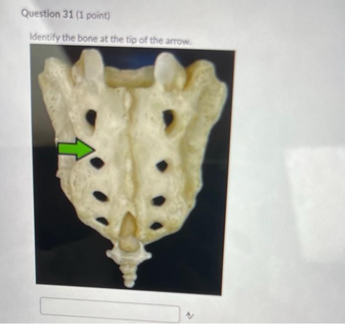 Solved Idanbicu. the Identify the bone at the tip of the | Chegg.com