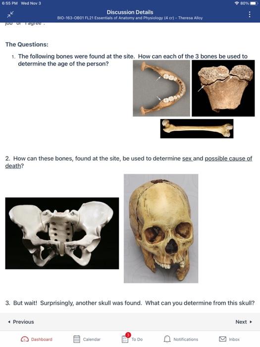 Solved The following bones were found at the site. How can | Chegg.com