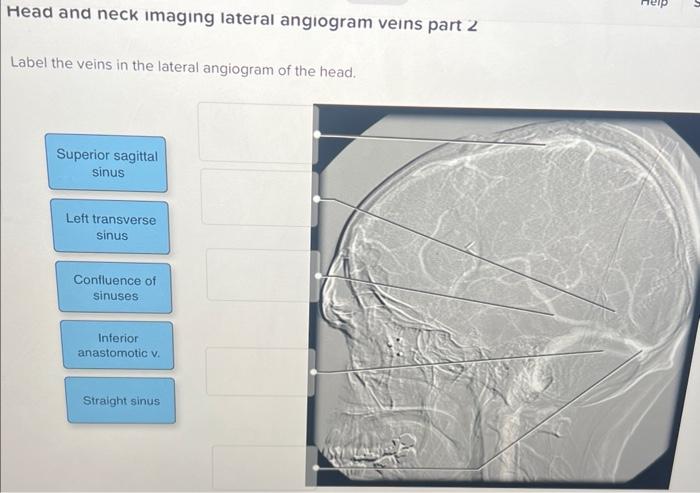 Solved head and neck imaging lateral angiogram veins part | Chegg.com