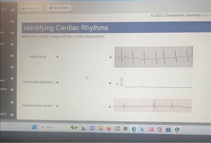 Match each rhythm image with the correct | Chegg.com
