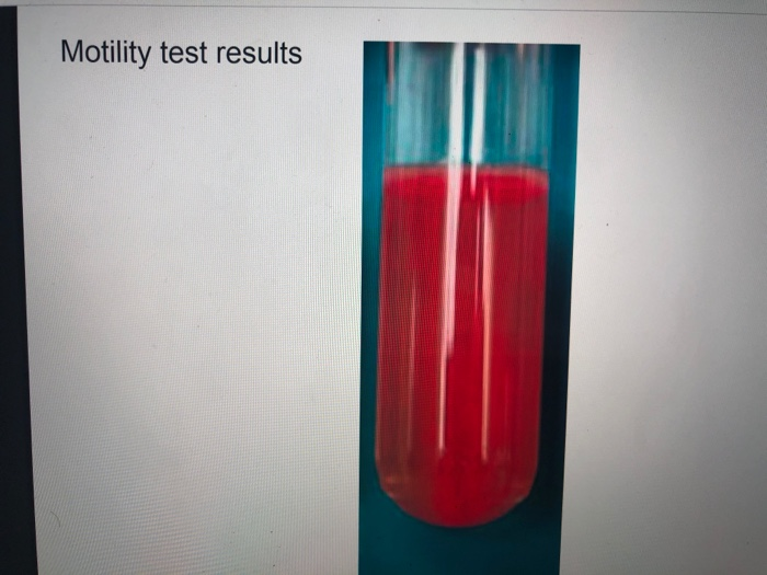 Methyl-red test results P Views Text Dawn Motility | Chegg.com