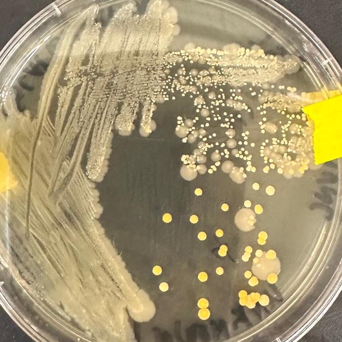 Solved How would you describe these 2 plates? (colony | Chegg.com