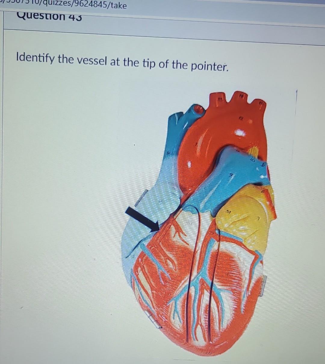 Solved Identify the vessel at the tip of the | Chegg.com