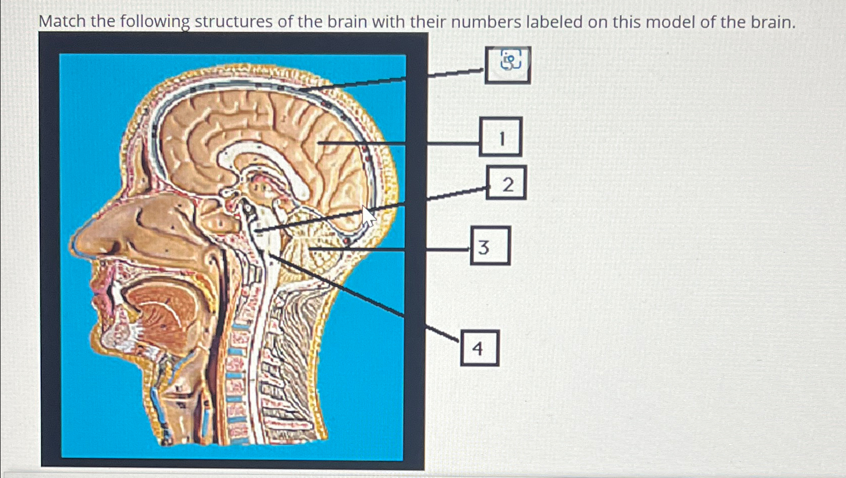 Solved Match the following structures of the brain with | Chegg.com