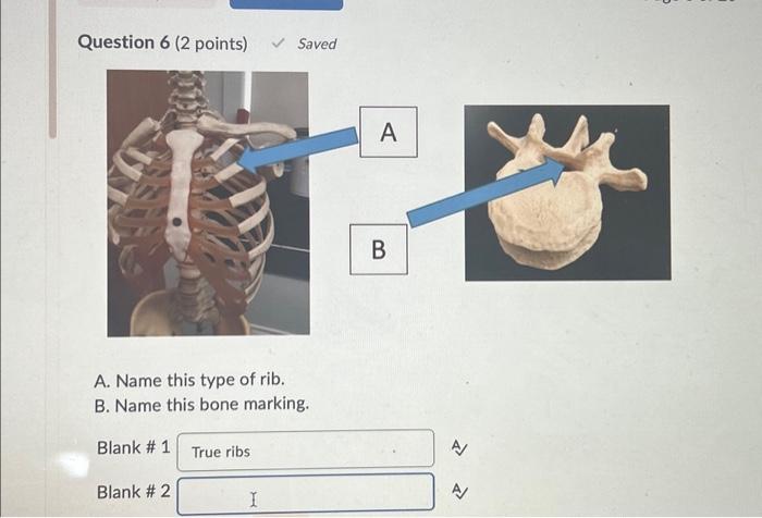 Question 6 (2 points) A. Name this type of rib. B. | Chegg.com