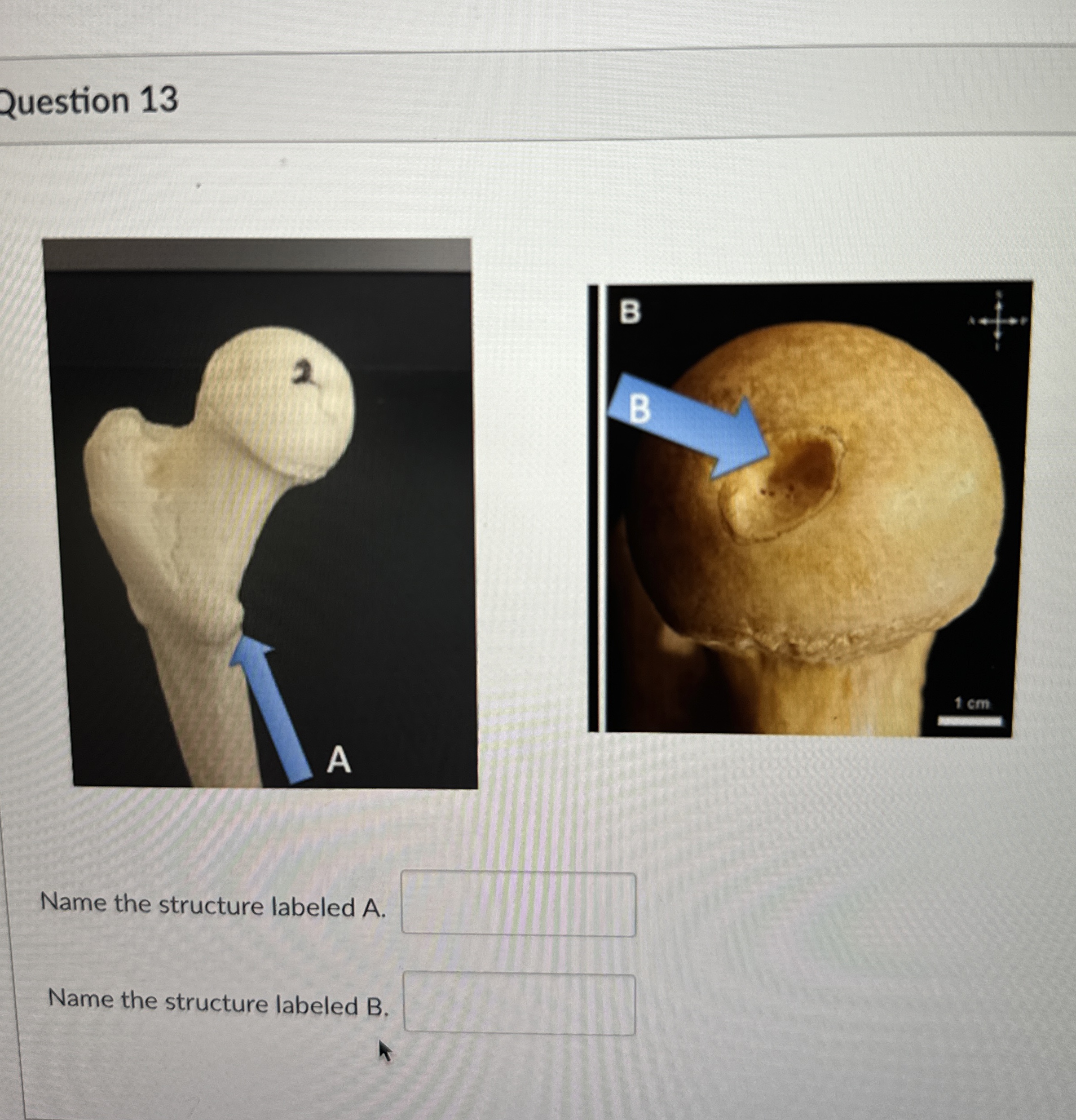 Solved Question 13Name the structure labeled A.Name the | Chegg.com