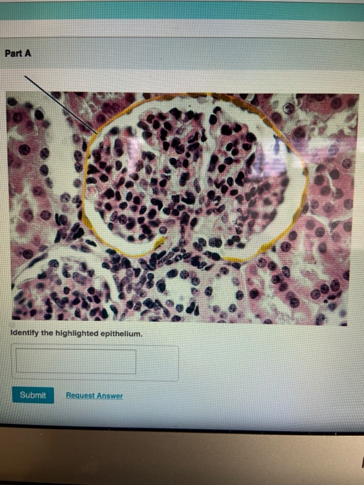Solved Part A Identify the highlighted epithelium. Submit | Chegg.com