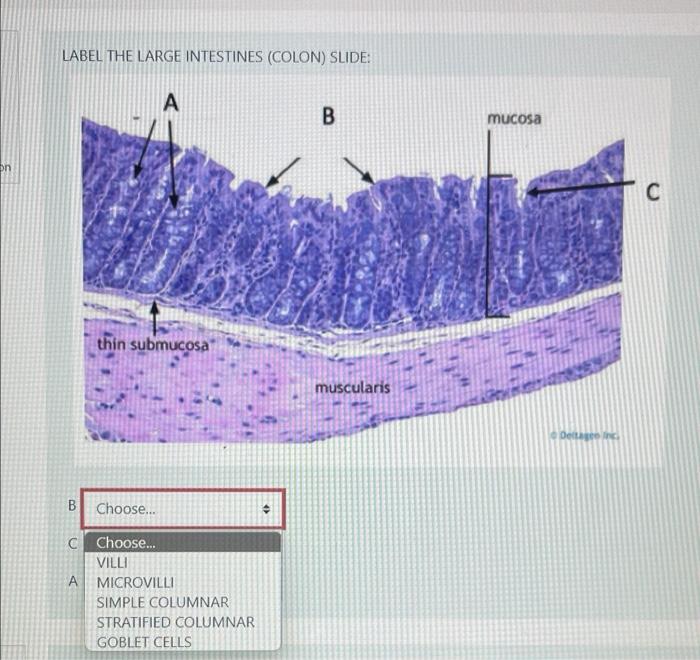 Solved LABEL THE LARGE INTESTINES (COLON) SLIDE: А B mucosa | Chegg.com