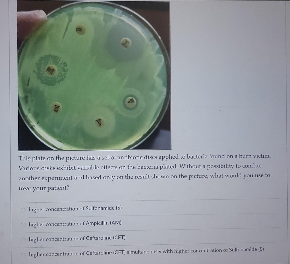 Solved This licture shows experiment UV sensitivity | Chegg.com
