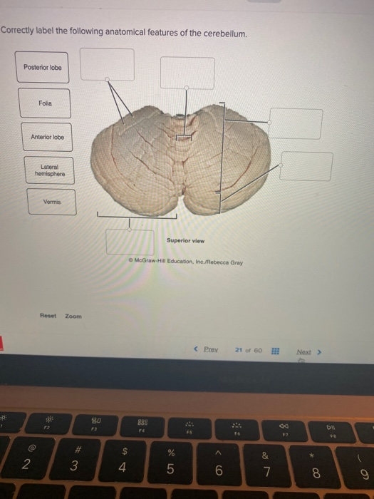 Solved: Correctly Label The Following Anatomical Features ... | Chegg.com