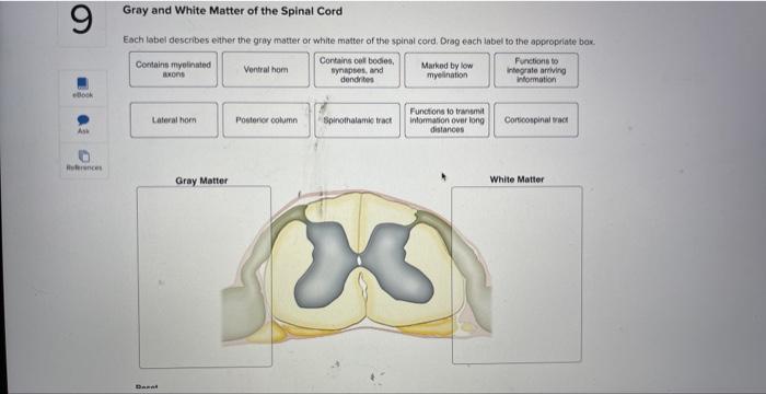 Solved Gray and White Matter of the Spinal Cord Each label | Chegg.com
