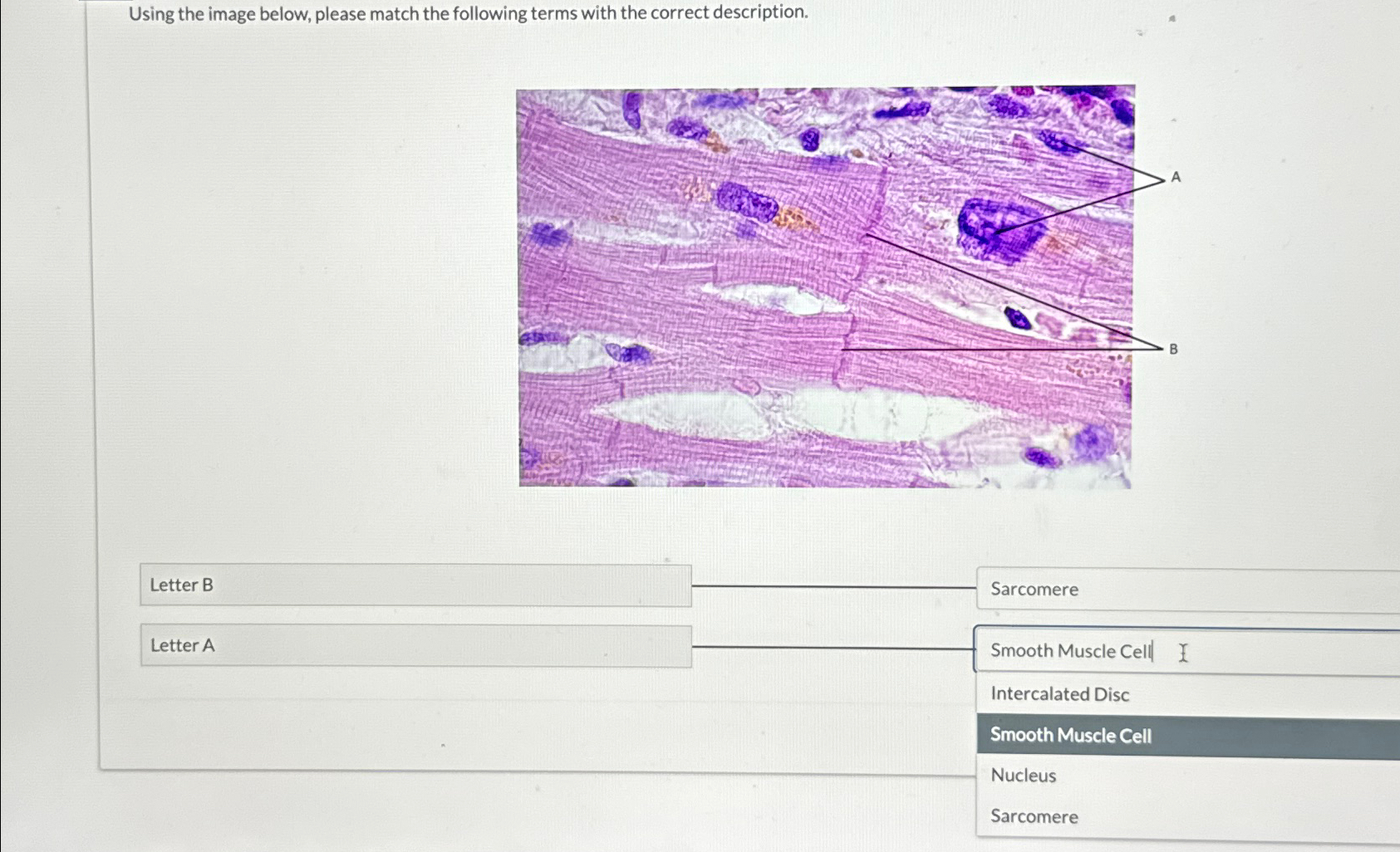 Solved Using the image below, please match the following | Chegg.com