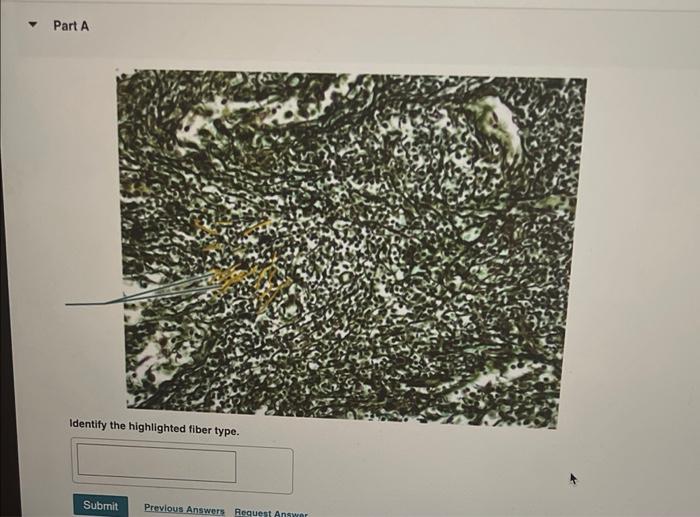 Solved Idenury the highlighted fiber type. Identify the | Chegg.com