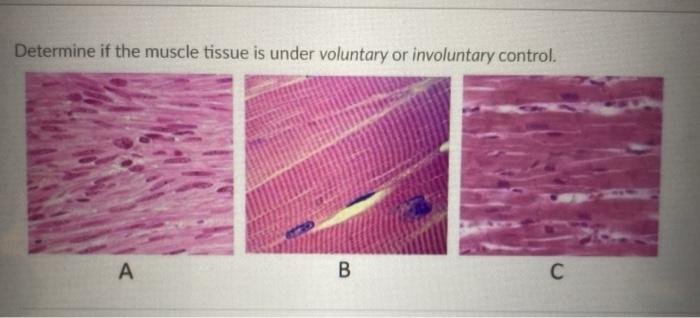 Solved Determine if the muscle tissue is under voluntary or | Chegg.com