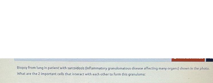 Solved Biopsy from lung in patient with sarcoidosis | Chegg.com