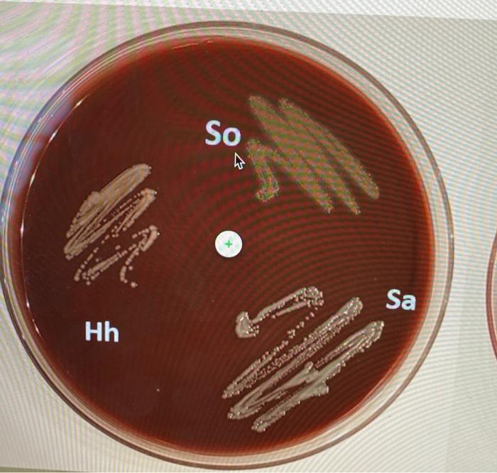 Solved B.CNA-blood Plate vs. Chocolate Agar: Growth and | Chegg.com