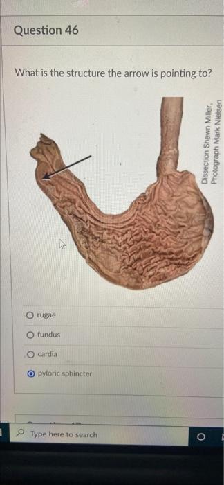 Solved Question 46 What is the structure the arrow is | Chegg.com