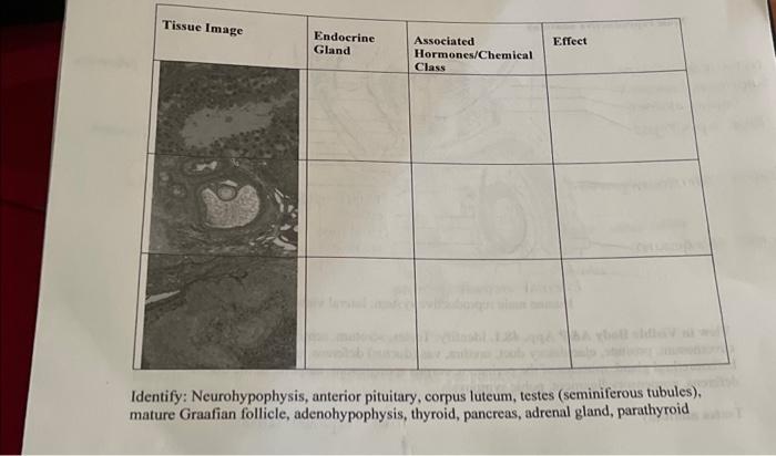 Solved Endocrine Slides Summary Table Identify: | Chegg.com