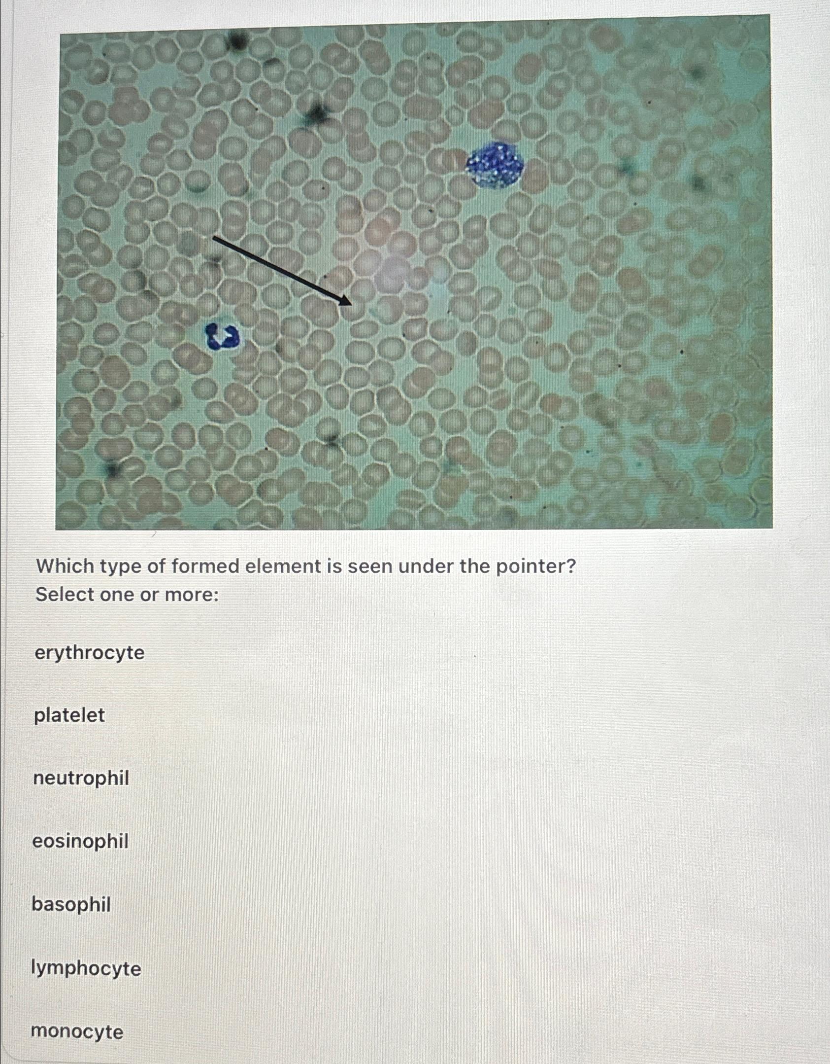 Solved Which type of formed element is seen under the | Chegg.com