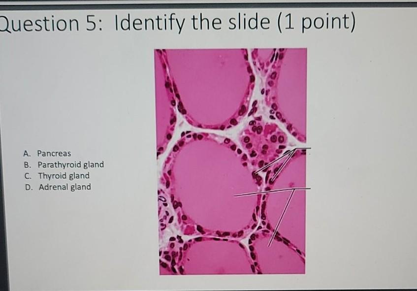 Solved Question 5: Identify the slide (1 point) A. Pancreas | Chegg.com