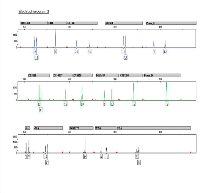 Solved Electropherogram 2 DIS1358 TID1 D1511 DIBS51 Penta I | Chegg.com