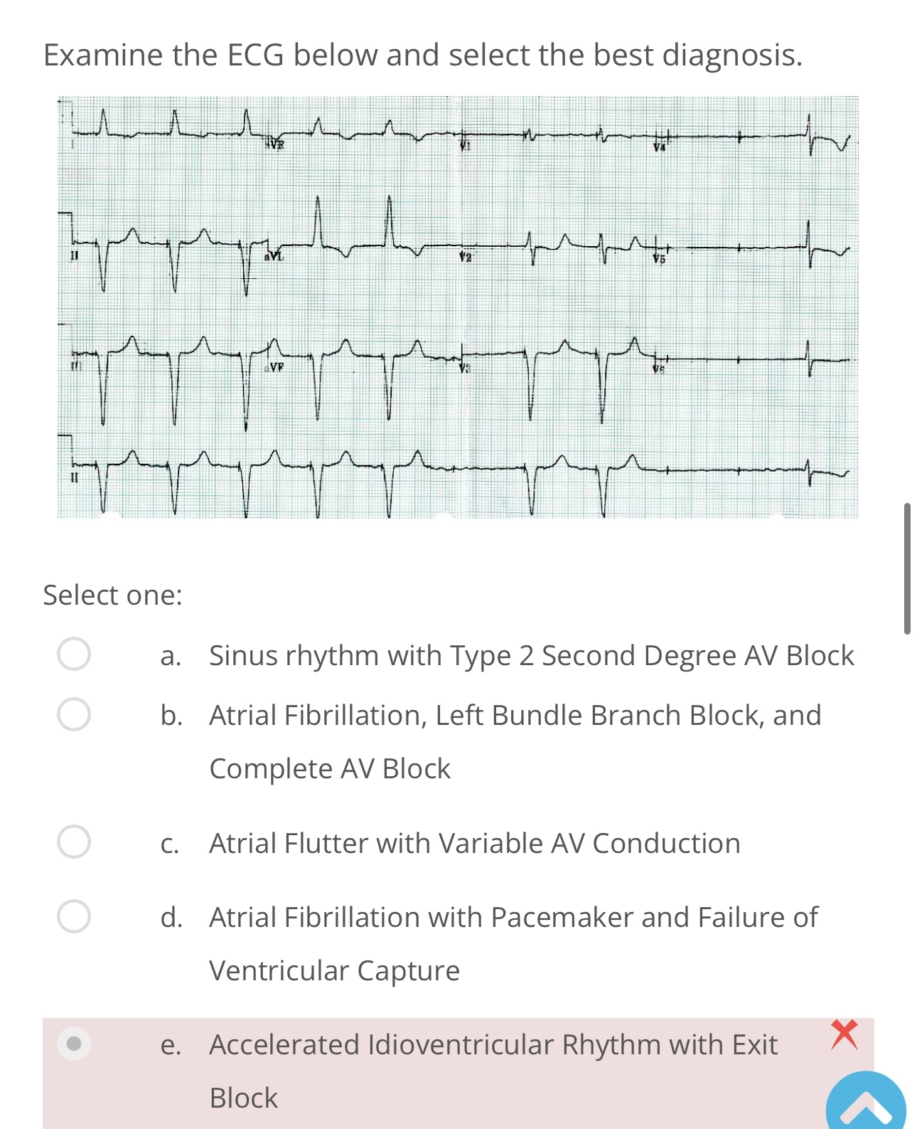 Solved Examine the ECG below and select the best | Chegg.com