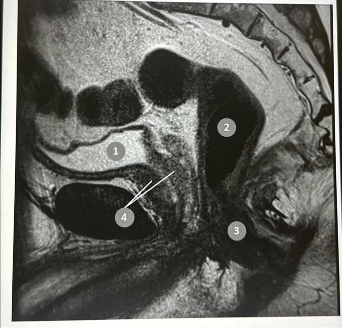 1,2,3,4 label of male reproduction organs: prostate | Chegg.com