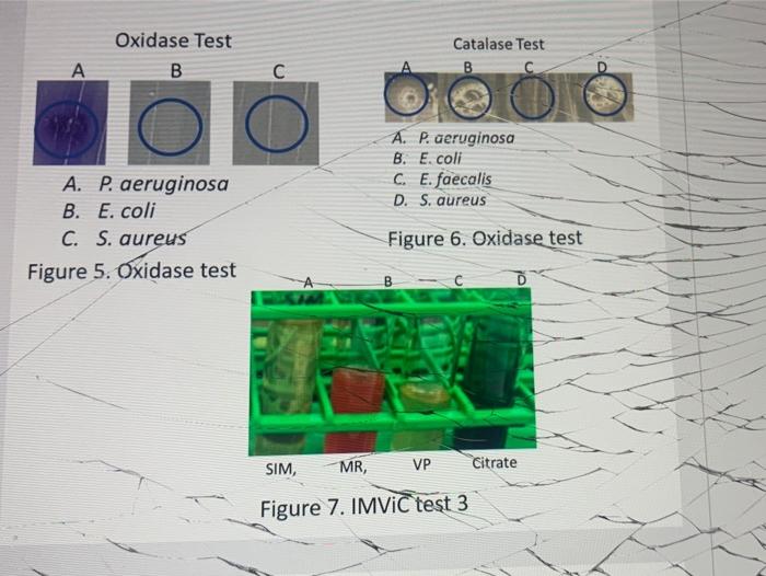 Solved IMVIC Test - Organism A Urease Test E. coli P. | Chegg.com