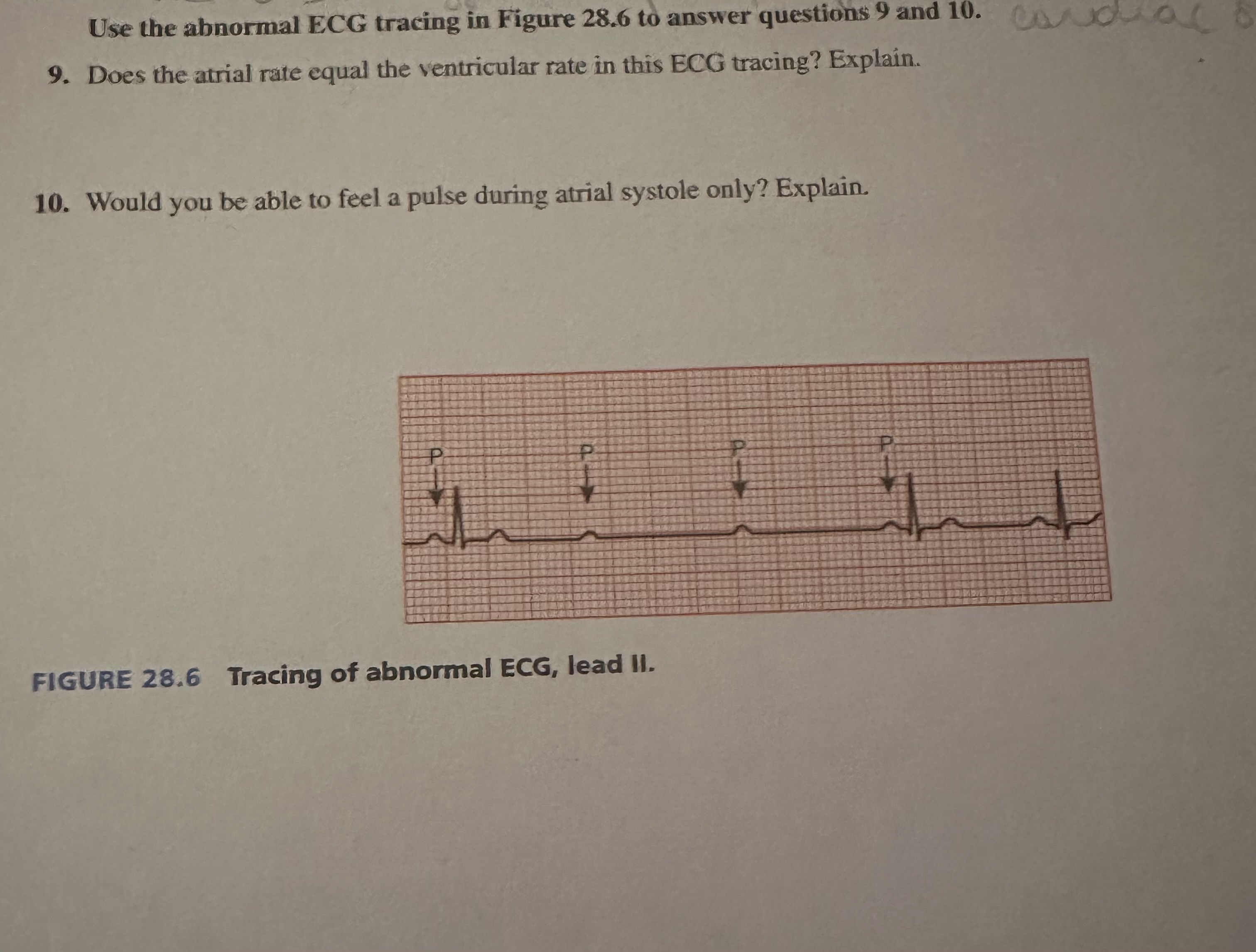 Solved Use the abnormal ECG tracing in Figure 28.6 ﻿to | Chegg.com