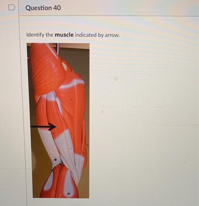 Solved Identify the muscle indicated by yellow | Chegg.com