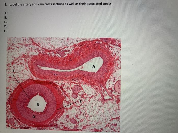 Solved 1. Label the artery and vein cross sections as well | Chegg.com