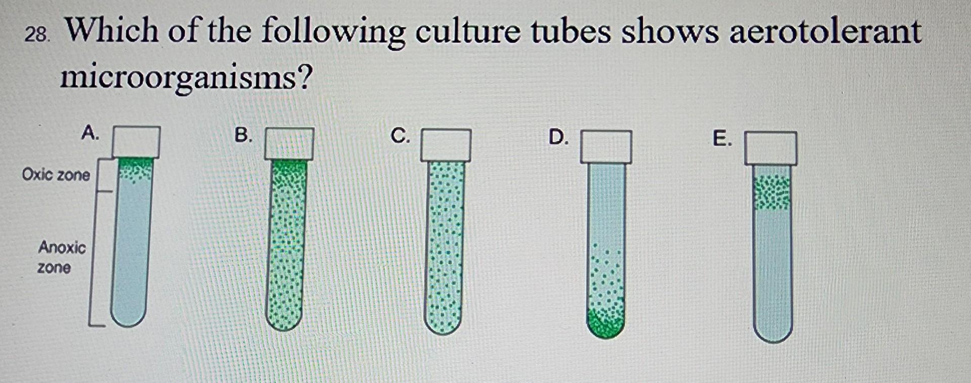 28. Which of the following culture tubes shows | Chegg.com