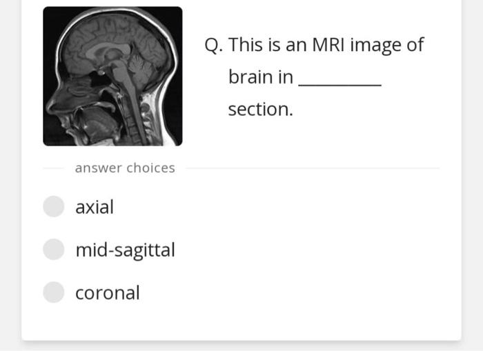Solved Q. This is an MRI image of brain in section. answer | Chegg.com