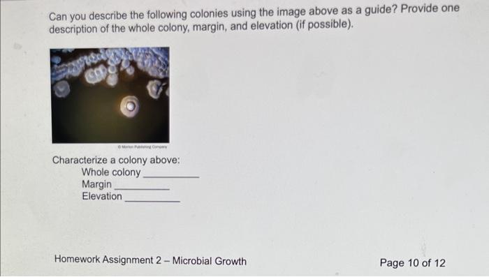 Solved Whole colony Round Irregular Spindle Filamentous | Chegg.com