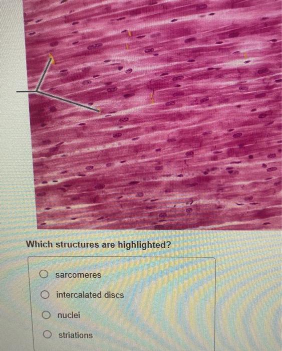Solved Identify the highlighted structure. Identify the | Chegg.com