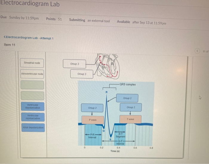 Solved Electrocardiogram Lab Due Sunday by 11:59pm Points 51 | Chegg.com