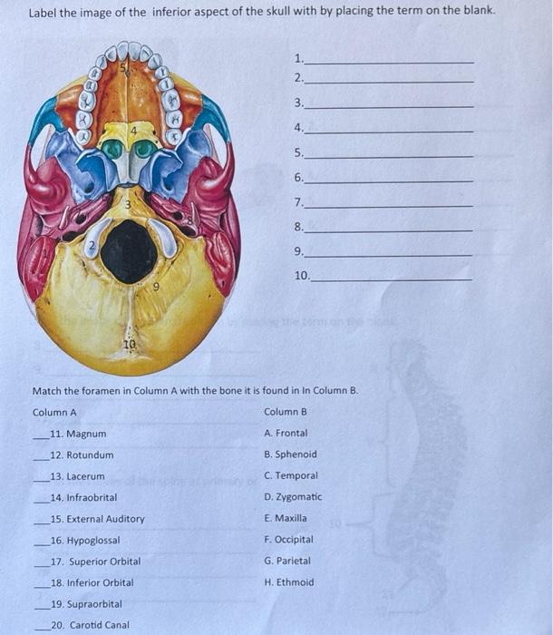 Solved Label the image of the inferior aspect of the skull | Chegg.com