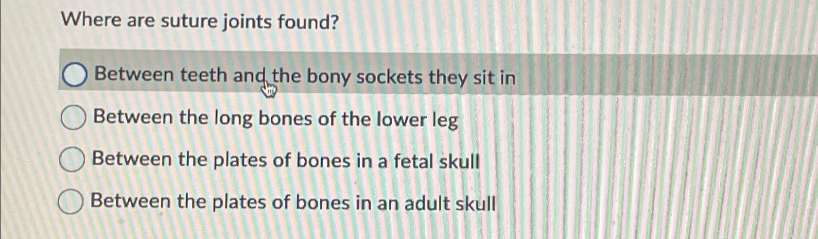 Solved Where are suture joints found?Between teeth and the | Chegg.com