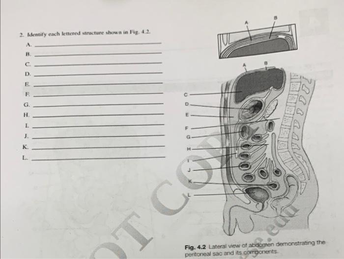 Solved 2. Identify each lettered structure shown in Fig. | Chegg.com