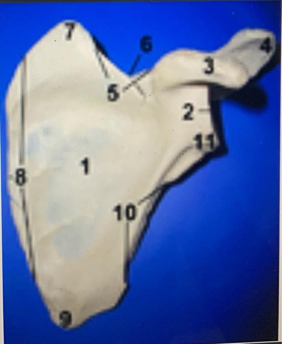 Solved • Identify the marks on the bone. | Chegg.com