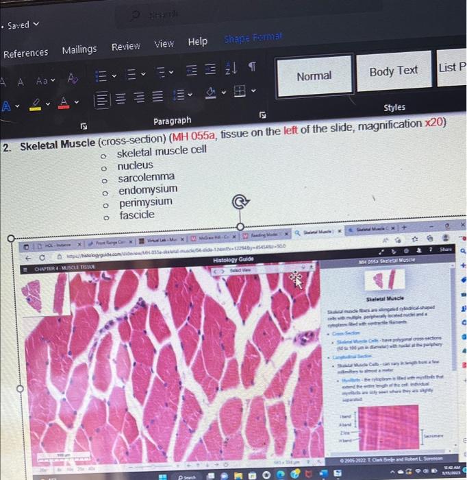 2. Skeletal Muscle (cross-section) (MH 055a, tissue | Chegg.com